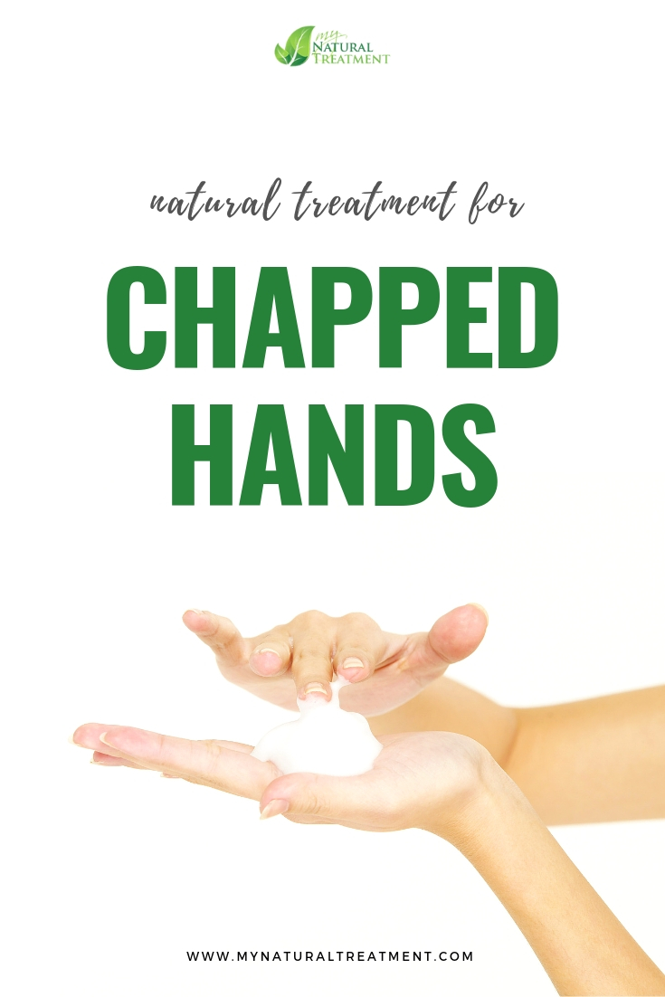 Natural Treatment for Chapped Hands with 1 Simple Tea