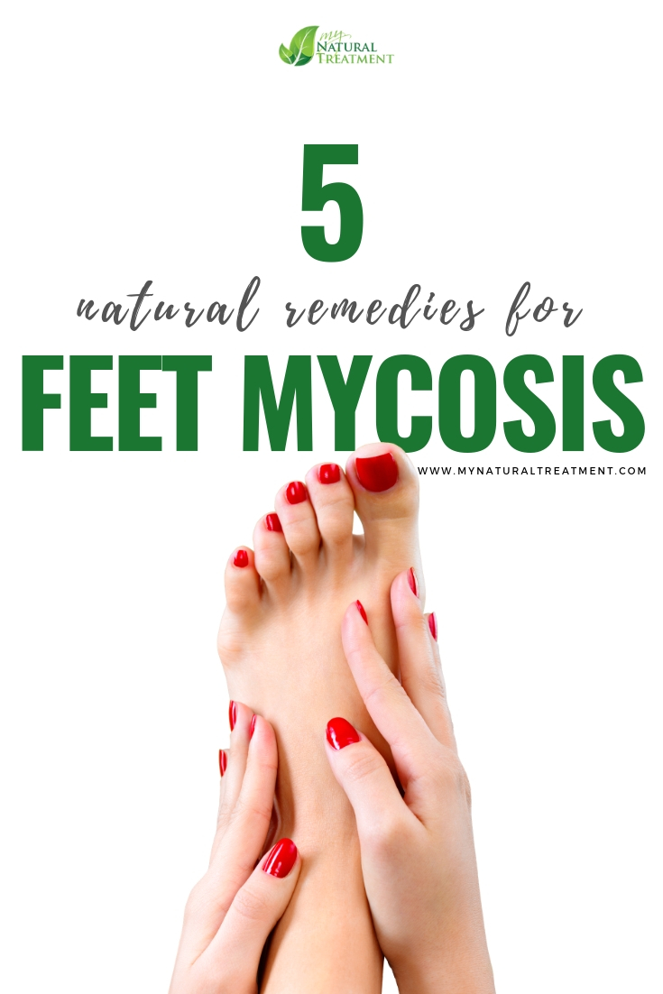 5 Natural Remedies for Feet Mycosis using Salt and Water