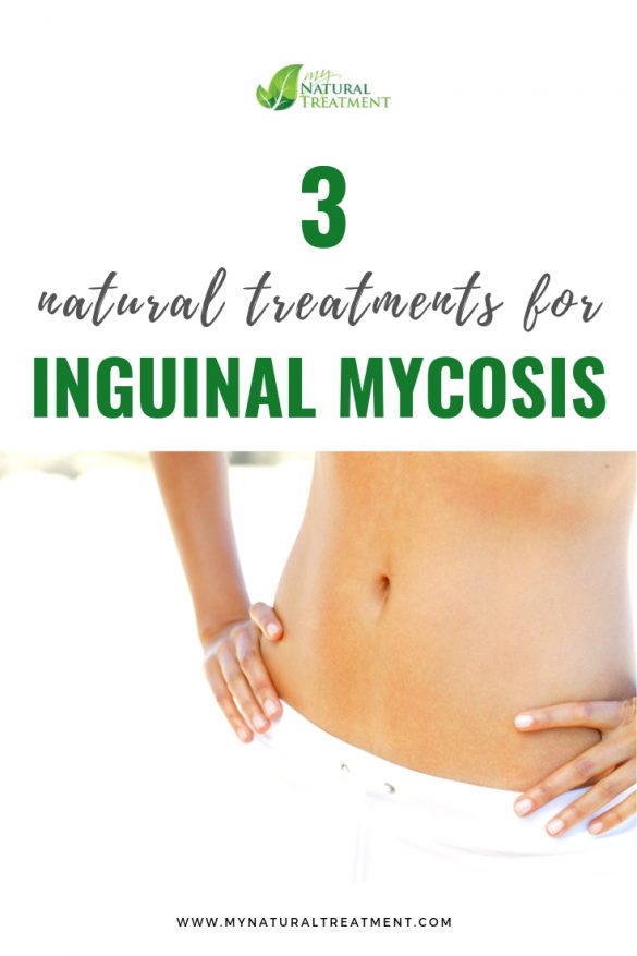 3 Natural Remedies for Inguinal Mycosis | Genital Mycosis