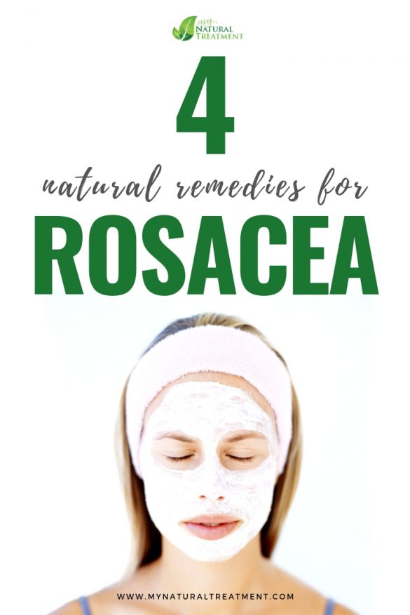 4 Natural Remedies for Rosacea with Herbs 🌿Rosacea Cure