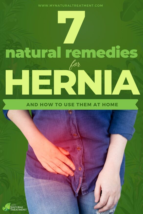 7 Powerful Natural Remedies for Hernia with Herbs that Work